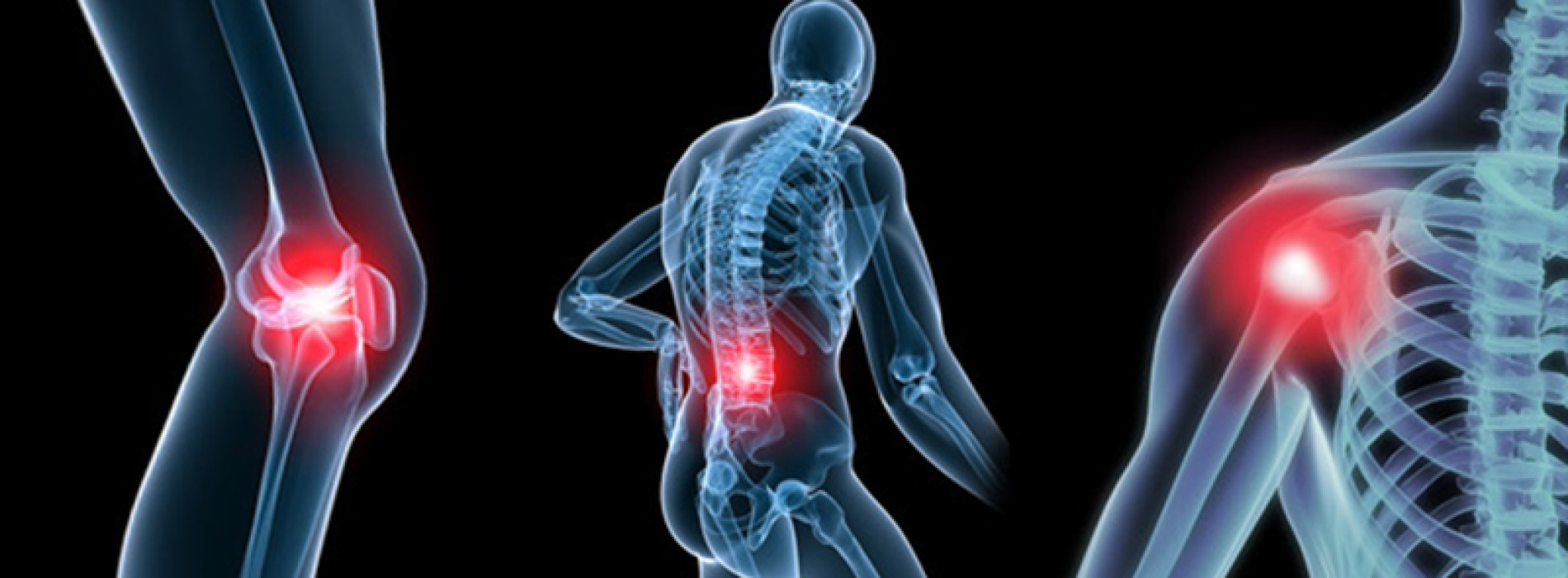 Arthritis in the UK: a closer look | Disability Horizons